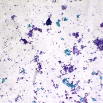 Yeast Slide A Protein Engineered, Enhanced Yeast Display Platform For