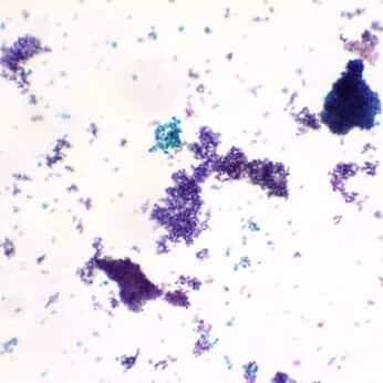 Yeast Fungi Slide Fungal Tests | Pathology Tests Explained