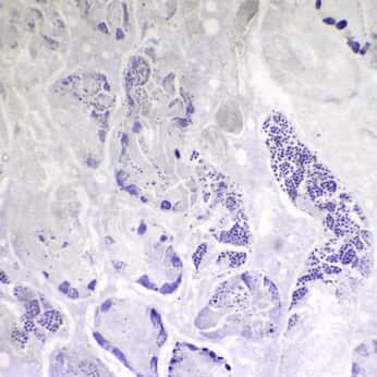 Cole-Parmer Prepared Slide, Animal Cell Mitosis, Grasshopper Testis ...