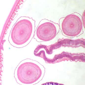 Cole-Parmer Prepared Slide, Animal Cell Mitosis, Ascaris (Roundworm), Mitosis, Sec from Cole ...