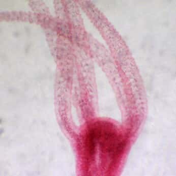 Hydra Biology Slide Asexual Reproduction In Hydra. Hydra “budding”