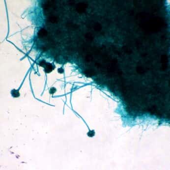 Aspergillus Slide Aspergillus Under The Microscopic View For Education