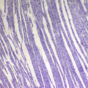 Cole-Parmer Prepared Slide, Muscle, 3 Types from Cole-Parmer