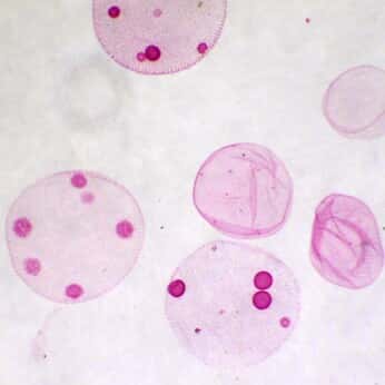 Volvox Slide 120+ Volvox Stock Photos, Pictures & Royalty Free Images