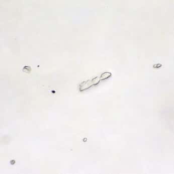 Cole-Parmer Prepared Slide, Bacteria, Smear From Mouth from Cole-Parmer