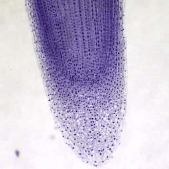Onion Root Tip Slide Onion Root Tip Mitosis Metaphase 01 Wards Mallory