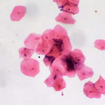 Human Cheek Cells Under A Microscope Human Cheek Cell Diagram Human