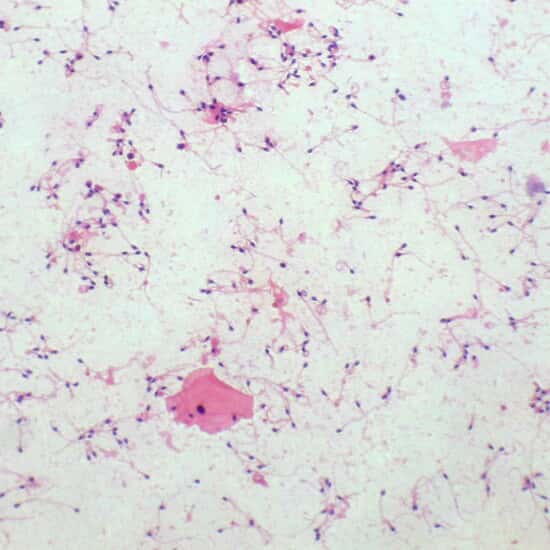 Cole-Parmer Prepared Slide, Human Sperm Smear from Cole-Parmer China