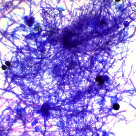 Cole-Parmer Prepared Slide, Bread Mold, Sexual from Cole-Parmer