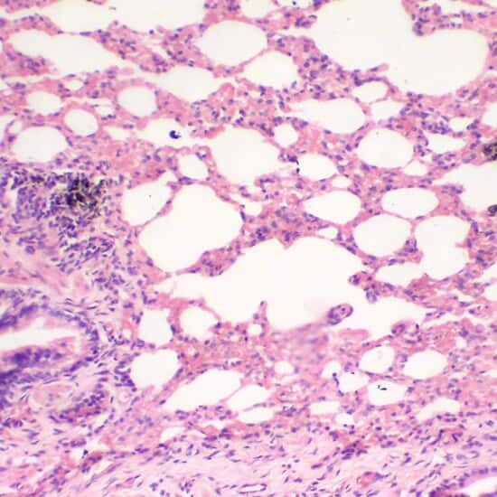Cole-Parmer Prepared Slide, Human Lung Tissue, Normal from Cole-Parmer