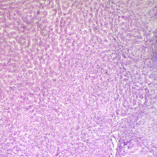 Cole-Parmer Prepared Slide, Human Liver Cells, Cirrhosis from Cole-Parmer