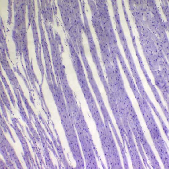 Cole-Parmer Prepared Slide, Muscle, 3 Types from Cole-Parmer
