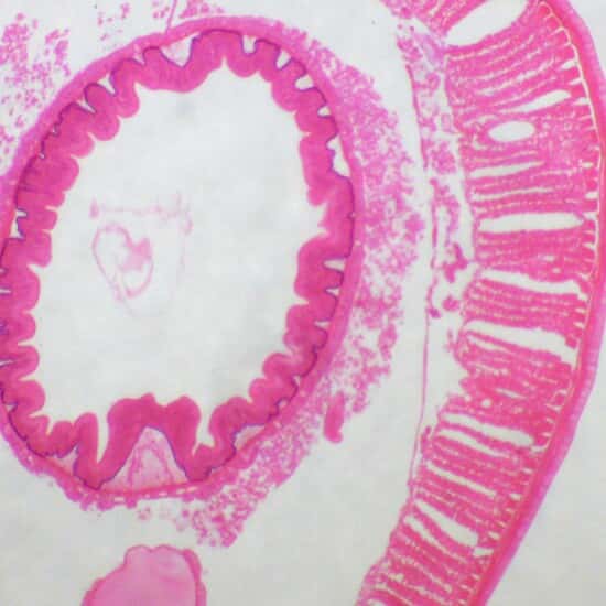 Cole Parmer Prepared Slide Earthworm Posterior Cs From Cole Parmer