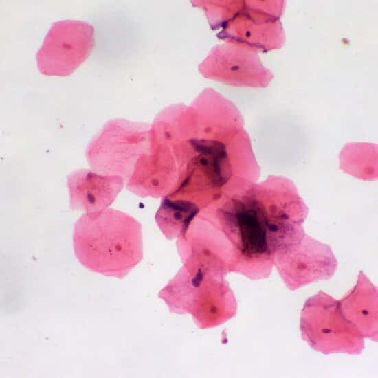 Cheek Epithelial Cells