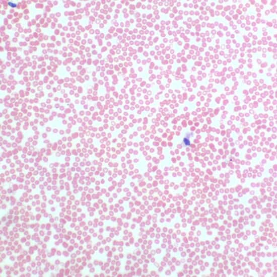 Cole-Parmer Prepared Slide, Human Blood Smear, Wright's Stain from Cole ...